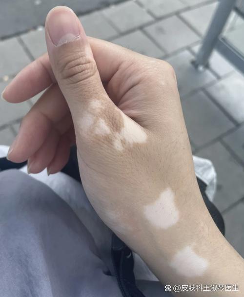 苹果手机屏幕出现两个白色圆点图标
