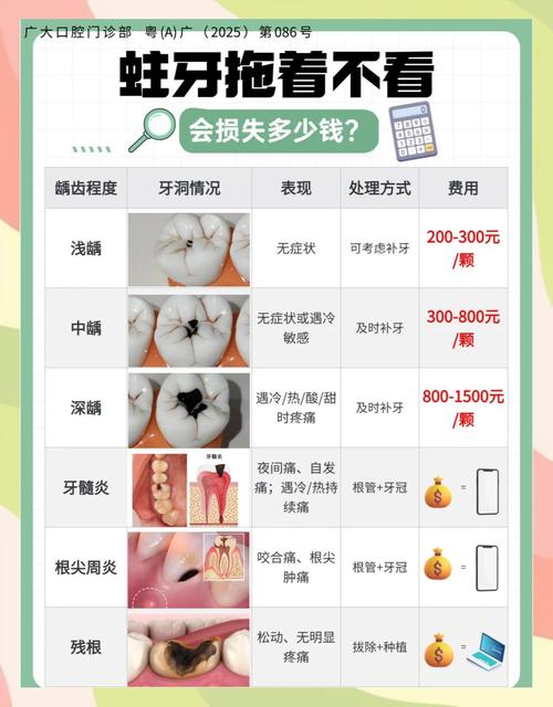 蛀牙修复多少钱一颗图标