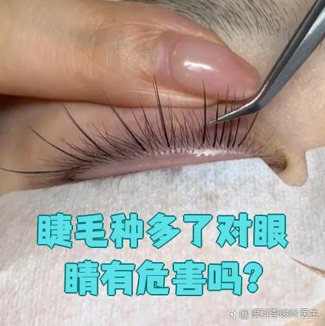 种接睫毛对眼睛好吗图标