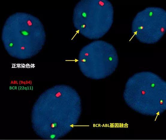 肿瘤fish检测是基因检测吗图标