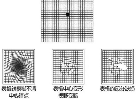 ipad屏幕边缘有黑影图标