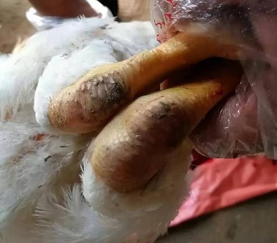 鸡儿水肿的原因截图