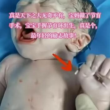 宝宝环可以传说吗截图