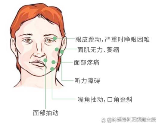 左边脸抽搐怎么回事图标