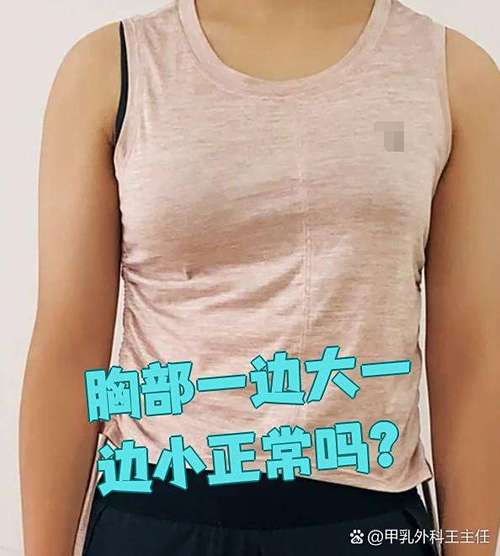 发育乳房一边大一边小正常吗