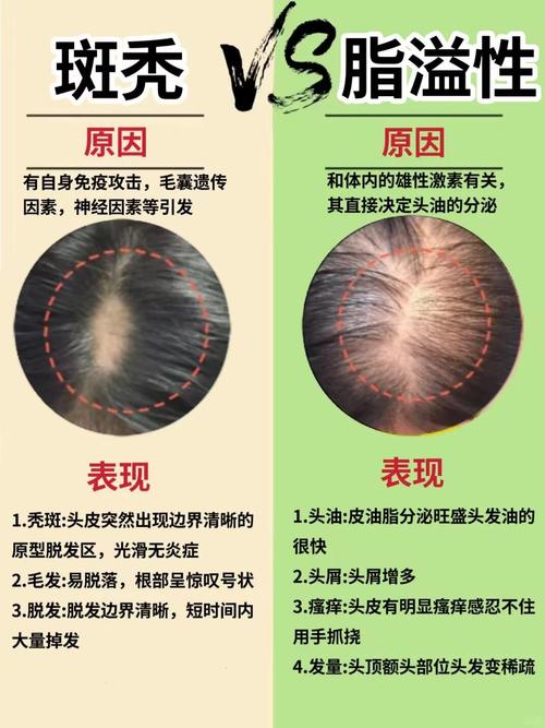 掉头发严重怎么调理图标