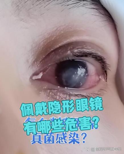 如何让监控摄像头失效图标