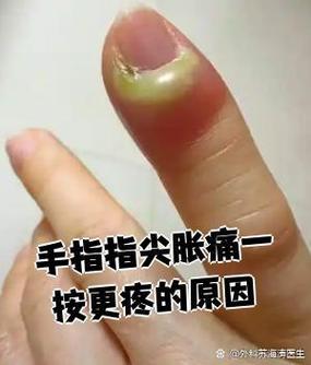 手指指尖按压没弹力图标