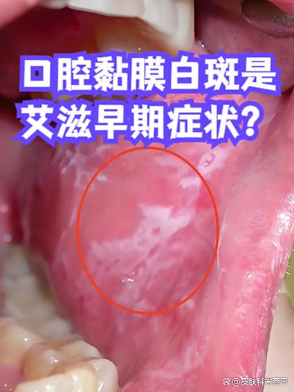 手机屏幕白色背景下有白色亮斑图标