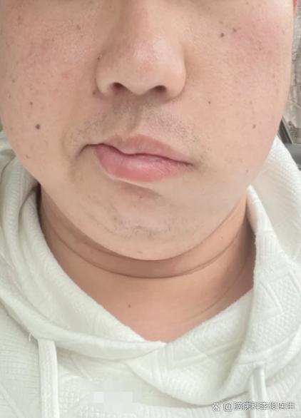 脸麻截图
