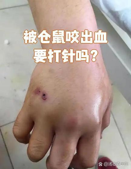 被小仓鼠咬破皮有事吗图标