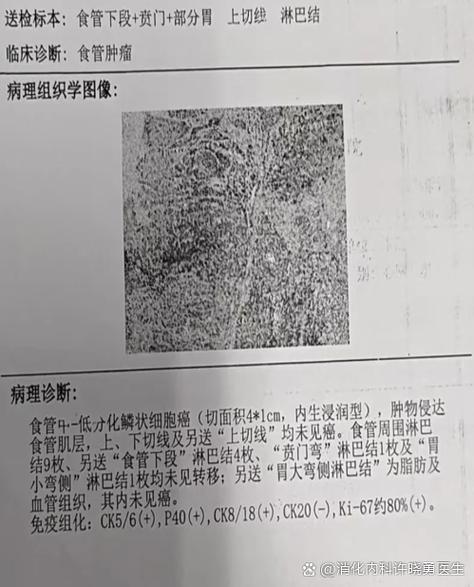 病理报告会直接写良性恶性吗截图