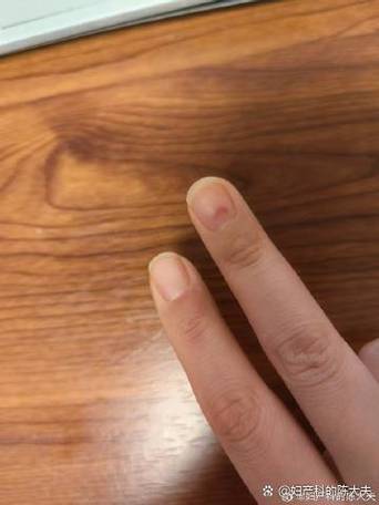 视频里的手不好看怎么修截图
