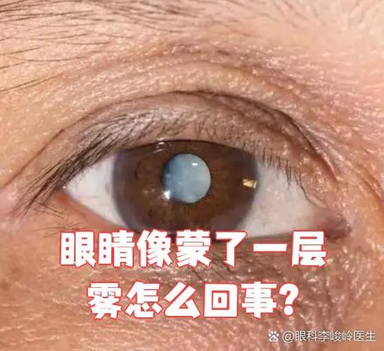 眼睛有一层雾蒙蒙的感觉图标
