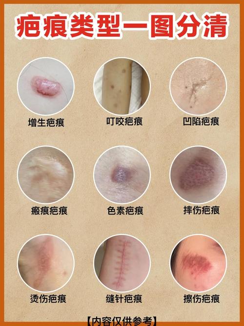 希薇尔无疤痕图标
