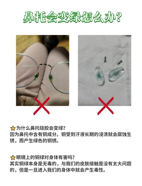 眼镜鼻托发绿是什么原因截图