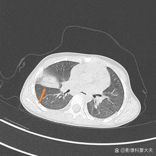 ct影片怎么在手机上观看截图