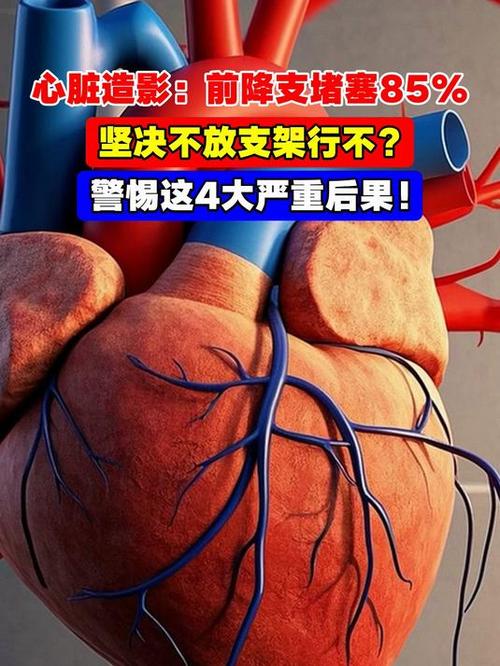 造影有什么危害图标