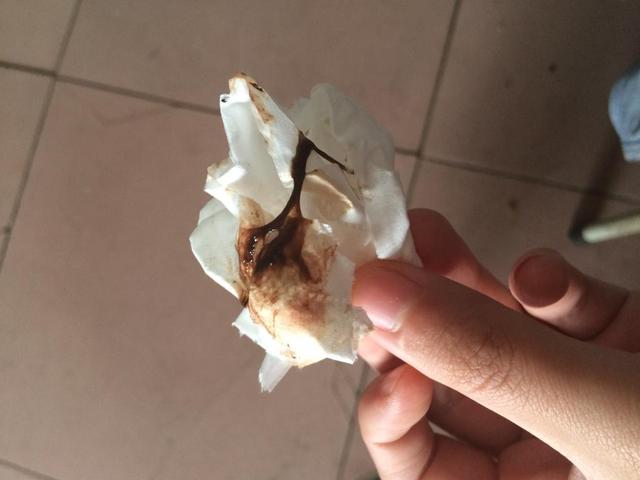 60岁有分泌物发黄不痒图标