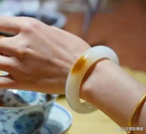 懂行的人建议买手环吗图标