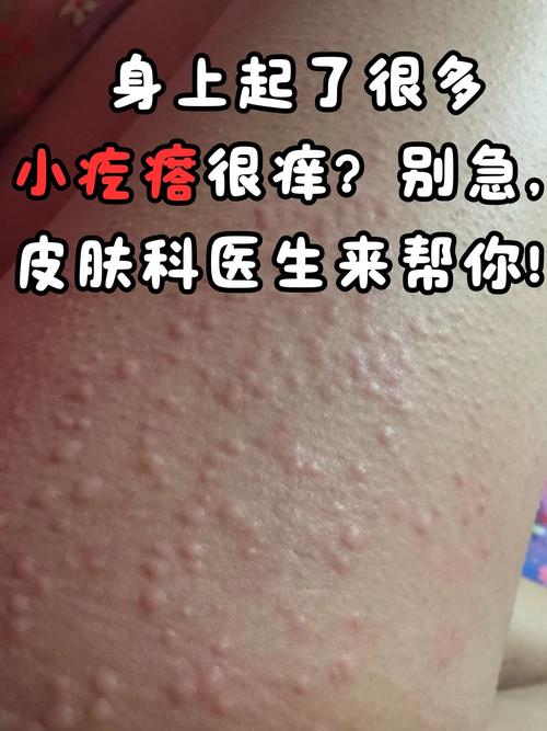 胳膊上痒痒的一挠就起小疙瘩图标