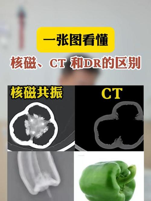 ct和核磁共振的区别图标