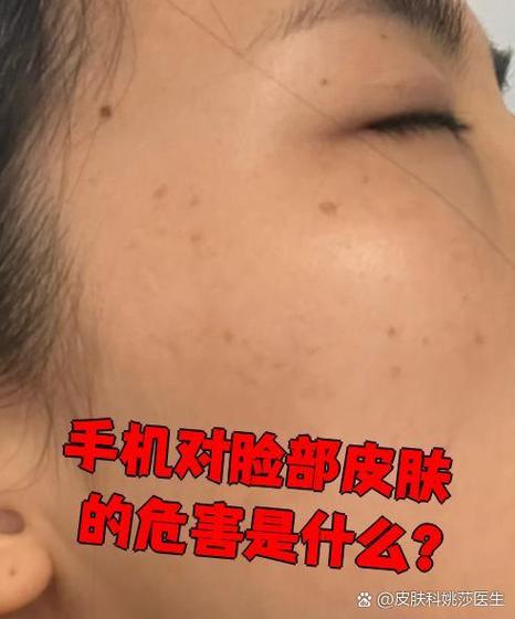 手机对脸部皮肤的危害图标