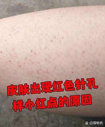 摄像头没有红点是什么样子图标
