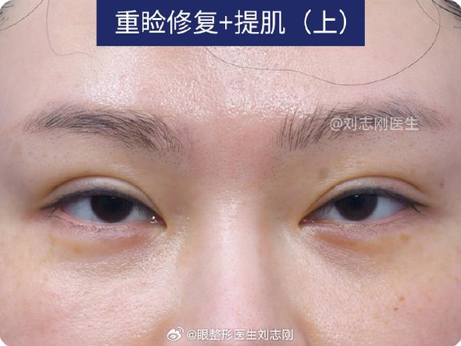 照片眼睛闭了如何修成睁眼图标