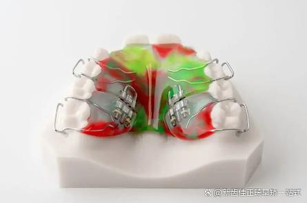 牙床歪斜导致脸嘴都歪图标
