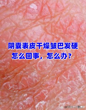 男人蛋皮瘙痒是怎么回事图标