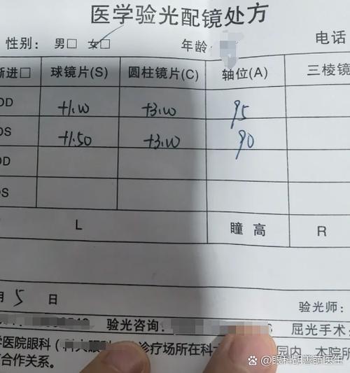 散光300多度严重吗怎么治疗图标