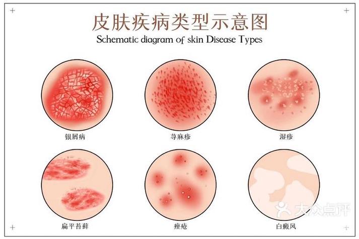 皮肤病扫一扫图标