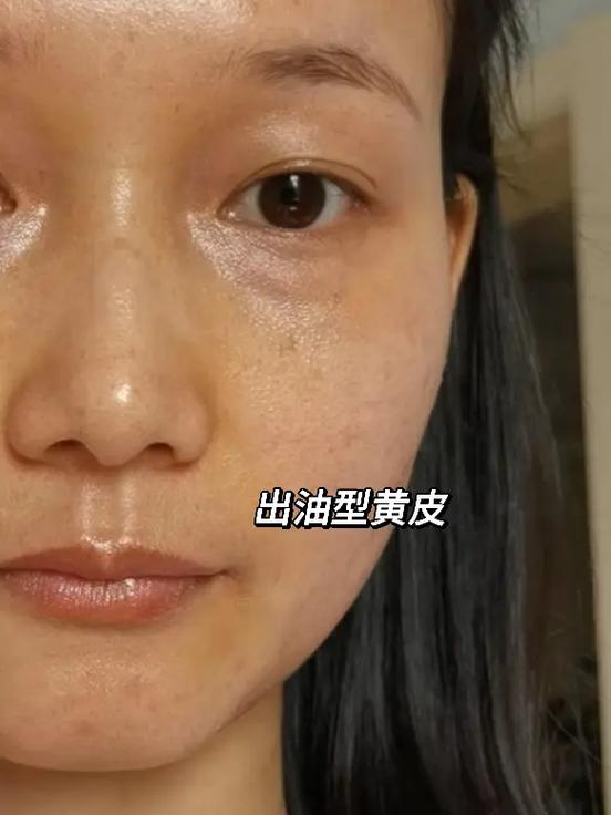 脸色突然发黄是什么原因图标