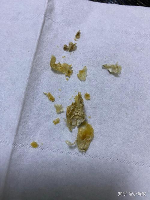 蓝牙耳机进耳屎了怎么清洗图标