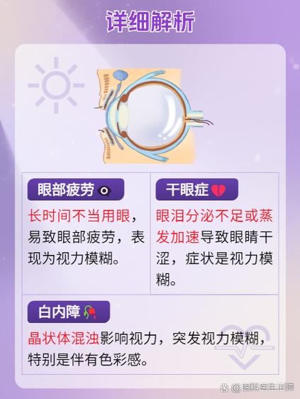 引起眼睛模糊的原因图标