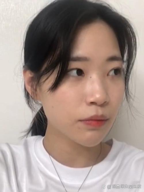 左脸肉软右脸肉硬的怎么回事图标