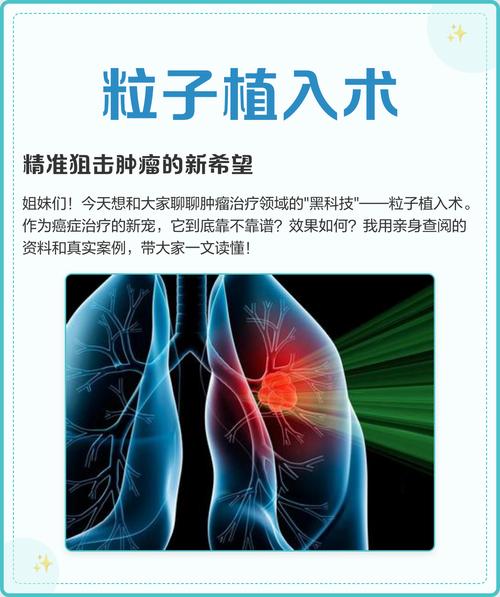 粒子植入辐射期多久图标