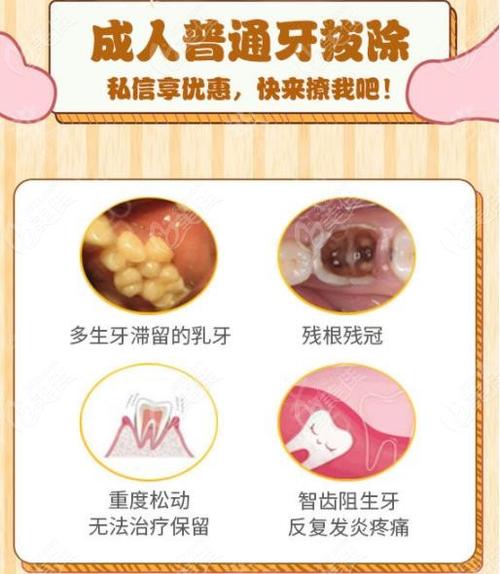 成人换门牙多少钱一颗图标