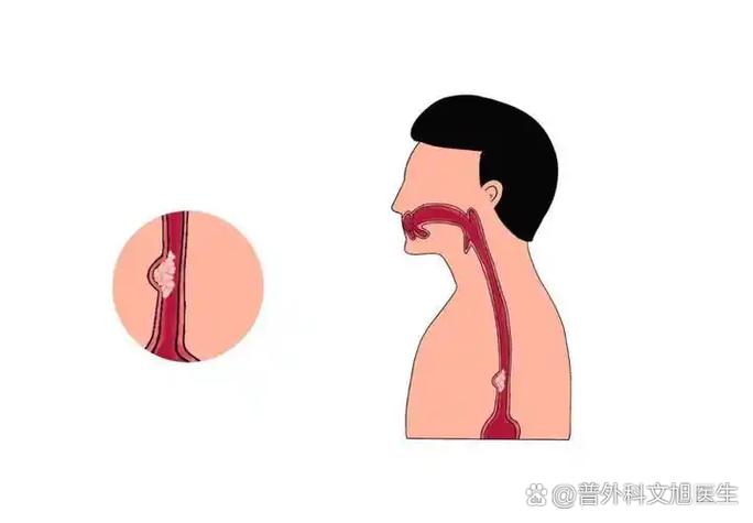 声音嘶哑的恢复方法图标