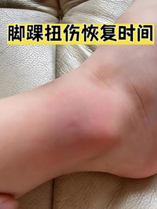 脚扭伤韧带损伤怎么治疗图标