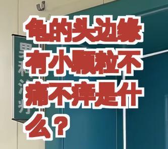 龟的头边缘有小颗粒不痛不痒截图