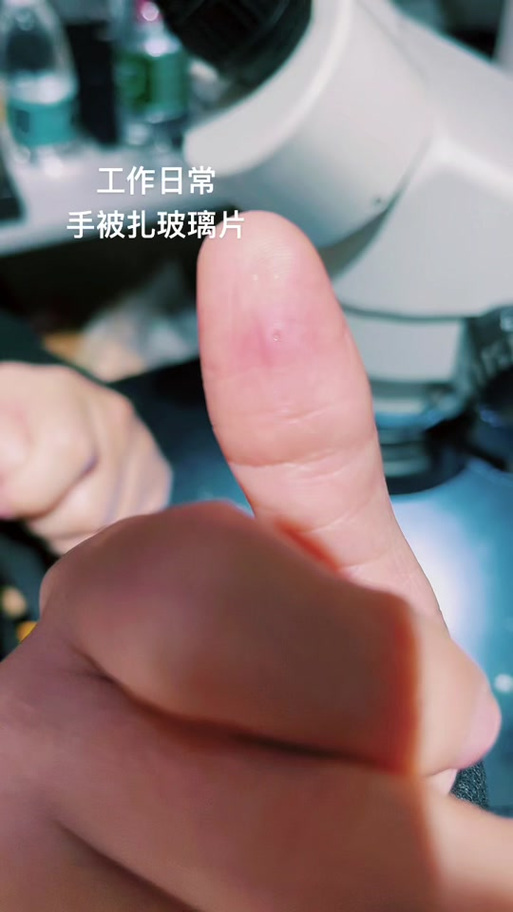 手里面扎了碎玻璃怎么弄出来图标