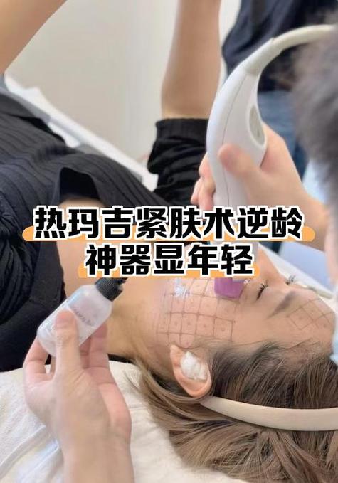 热玛吉的作用图标