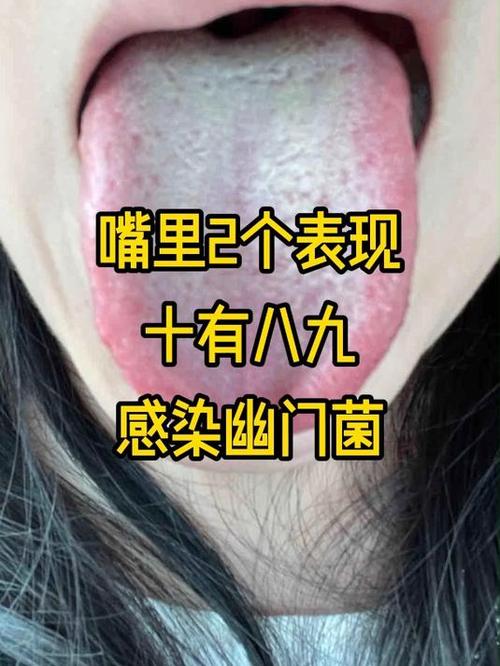 幽门螺杆菌症状图标
