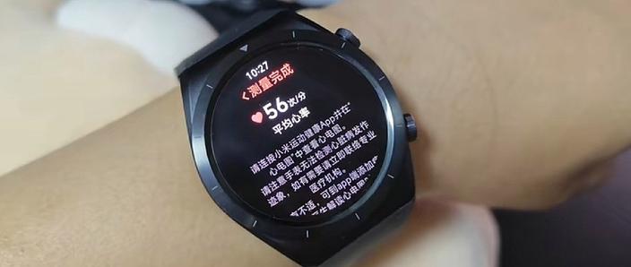 小米手表无法拨打电话图标