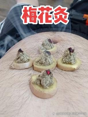 倪海厦中脘梅花灸图标