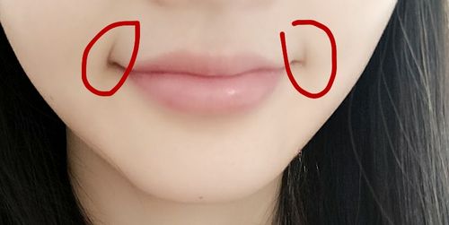 嘴两侧的纹路叫什么纹截图