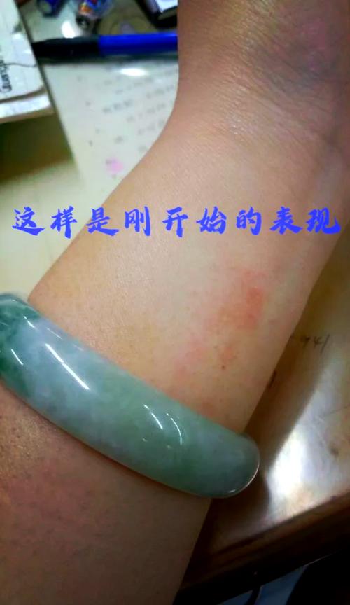 女人戴手环的害处图标