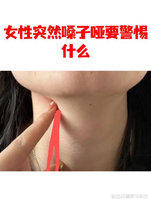 女人烟嗓是福还是祸图标